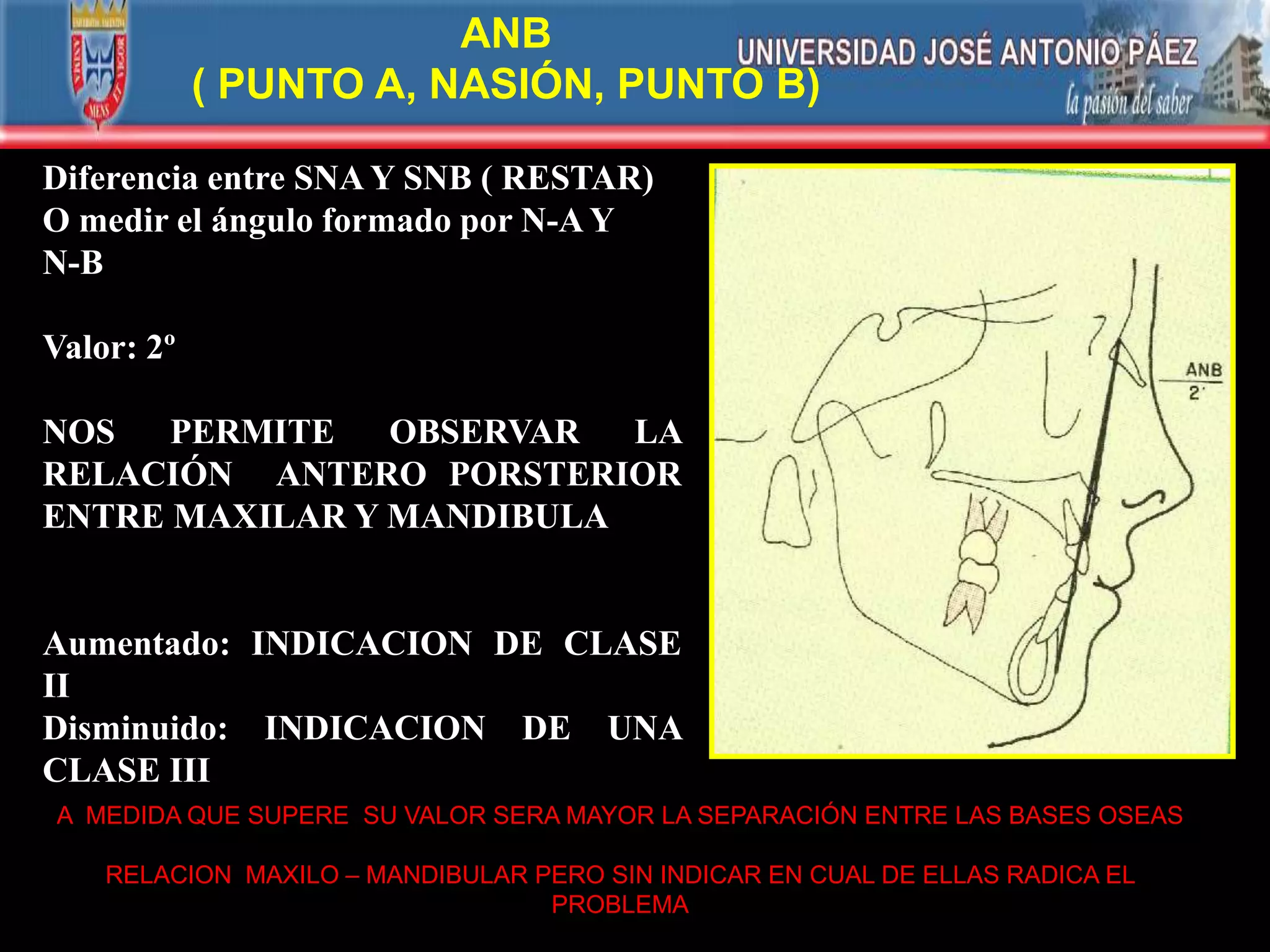 Cefalometria_Puntos_Planos_y_Angulos.ppt