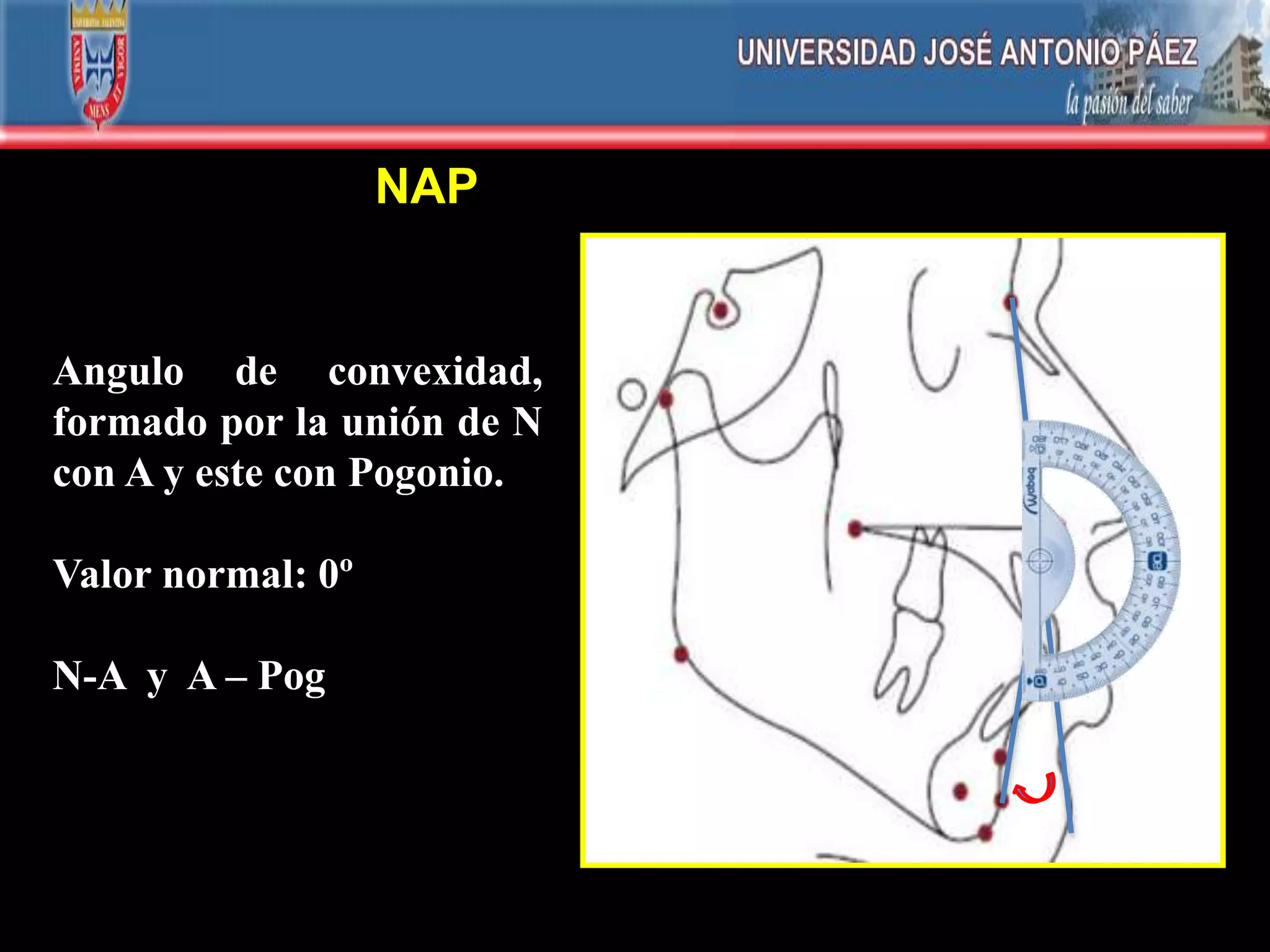 Cefalometria_Puntos_Planos_y_Angulos.ppt