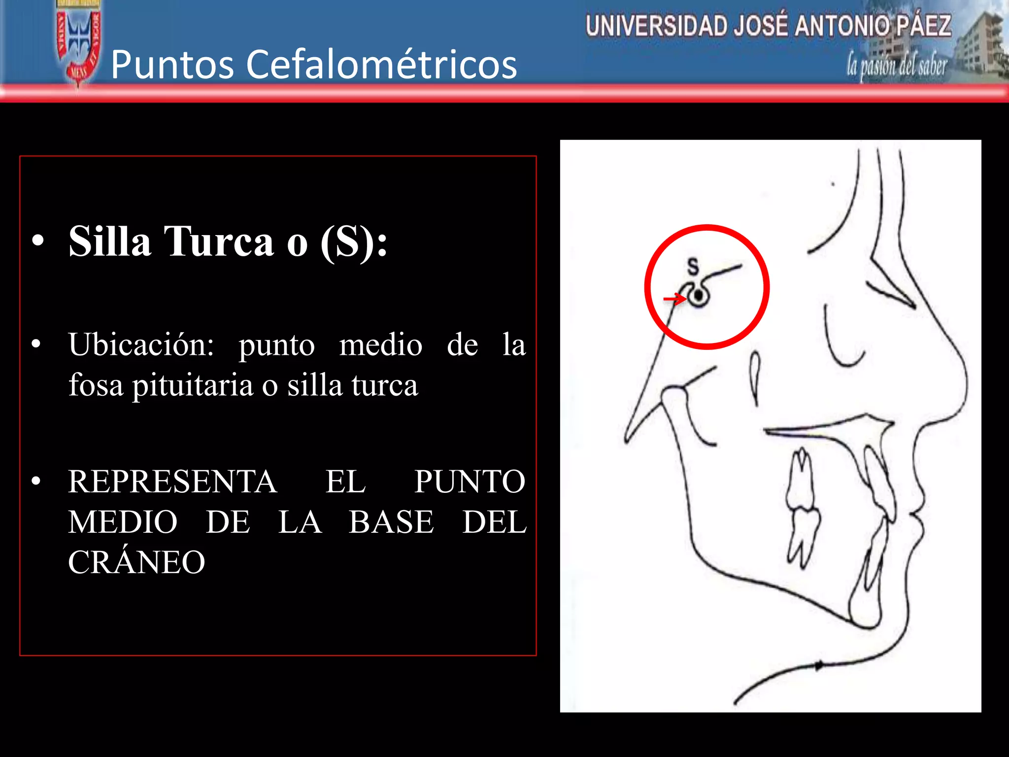 Cefalometria_Puntos_Planos_y_Angulos.ppt