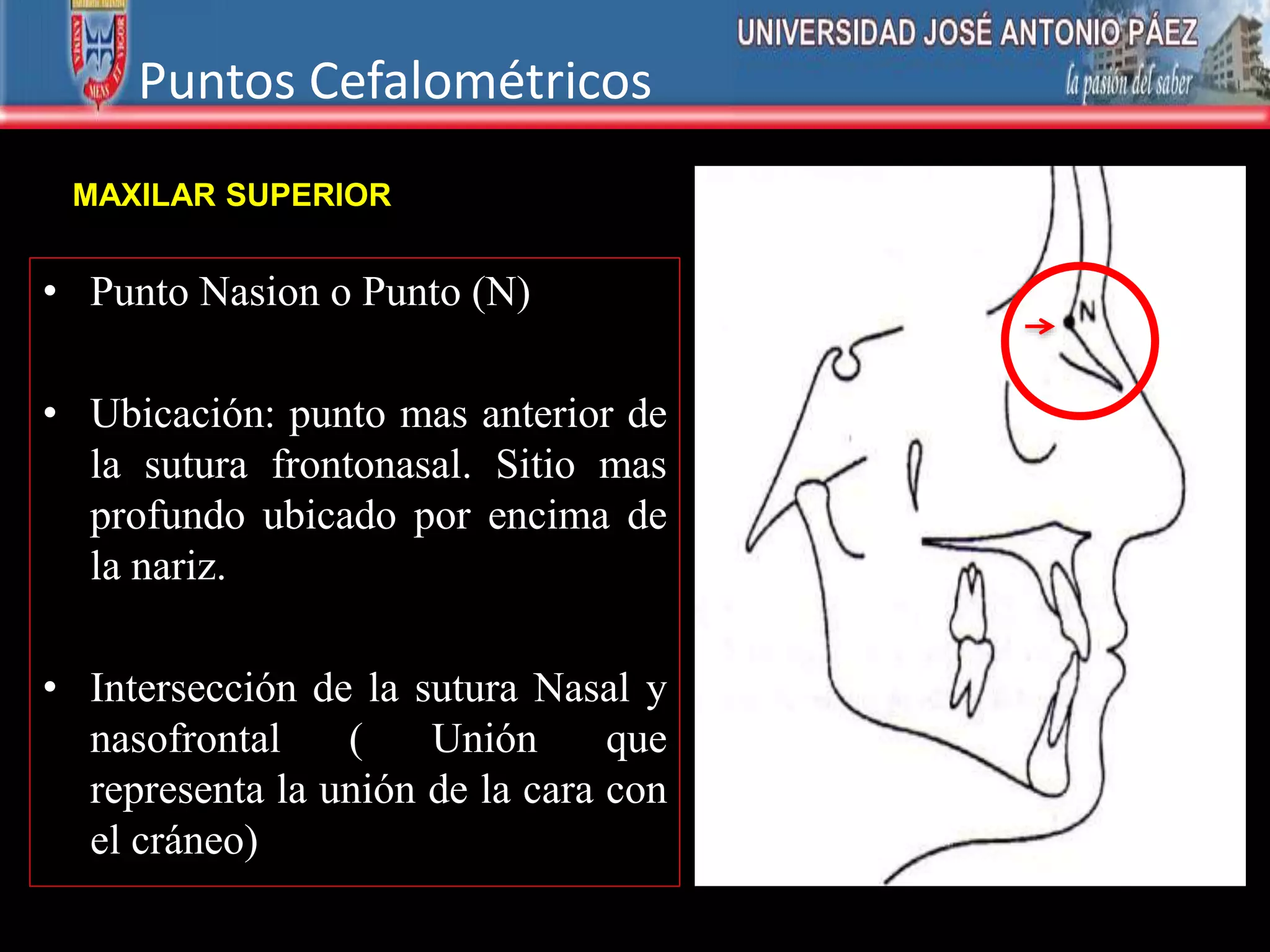 Cefalometria_Puntos_Planos_y_Angulos.ppt