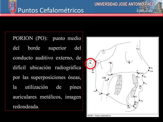 Cefalometria_Puntos_Planos_y_Angulos.ppt