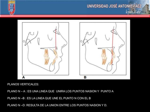 Cefalometria_Puntos_Planos_y_Angulos.ppt