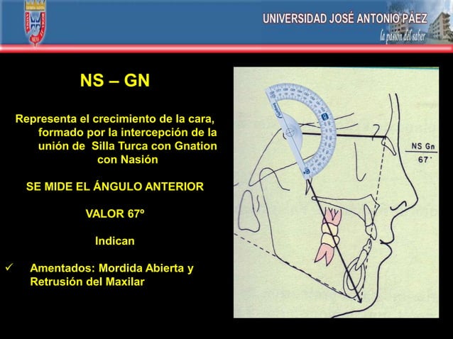 Cefalometria_Puntos_Planos_y_Angulos.ppt