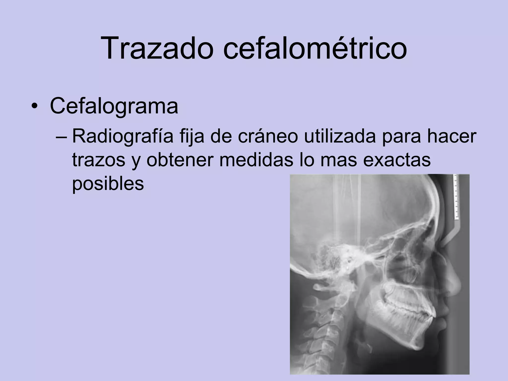 Cefalometria puntos y planos | PPTX
