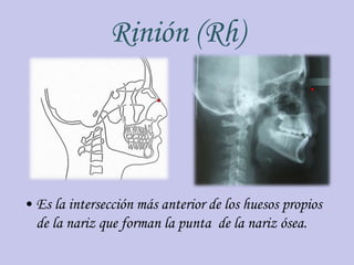 Cefalometria puntos y planos | PPTX
