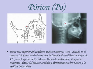 Cefalometria puntos y planos | PPTX
