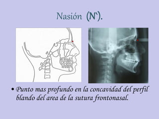 Cefalometria puntos y planos | PPTX
