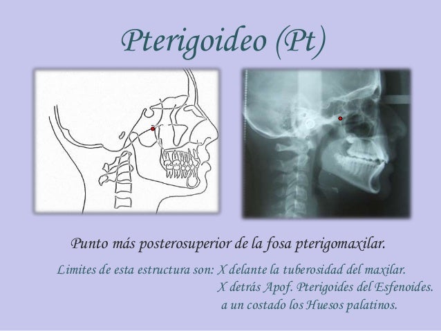 Cefalometria puntos y planos