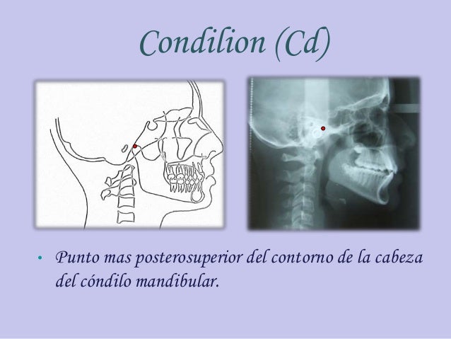 Cefalometria puntos y planos