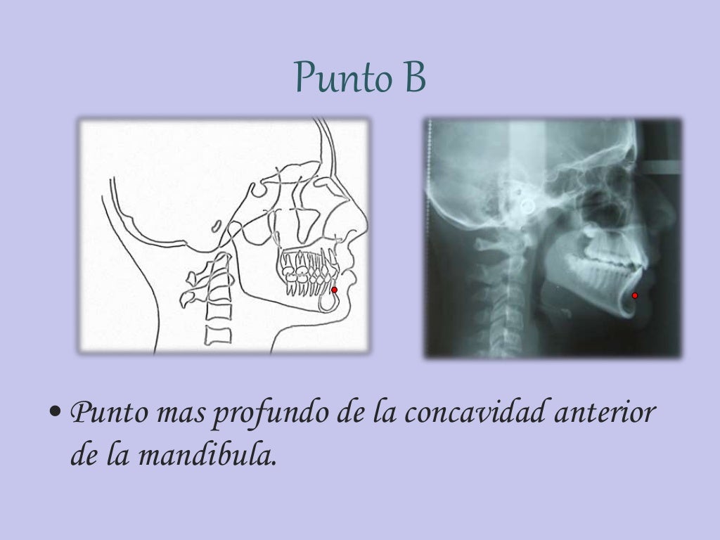 Cefalometria puntos y planos