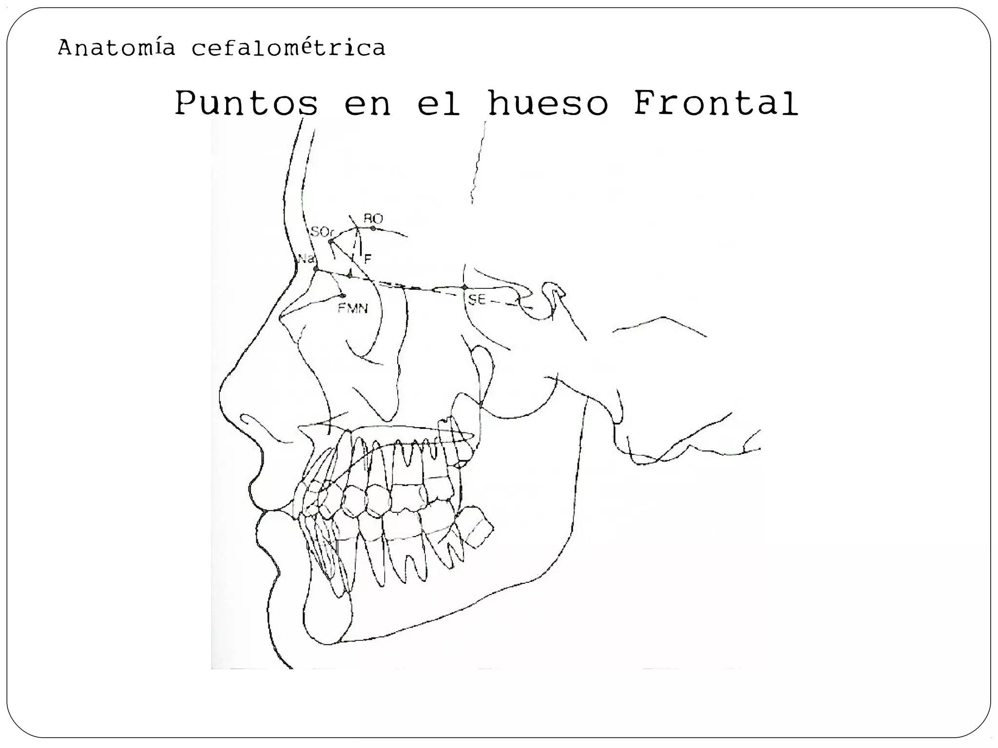 Cefalometria puntos y planos | PPT