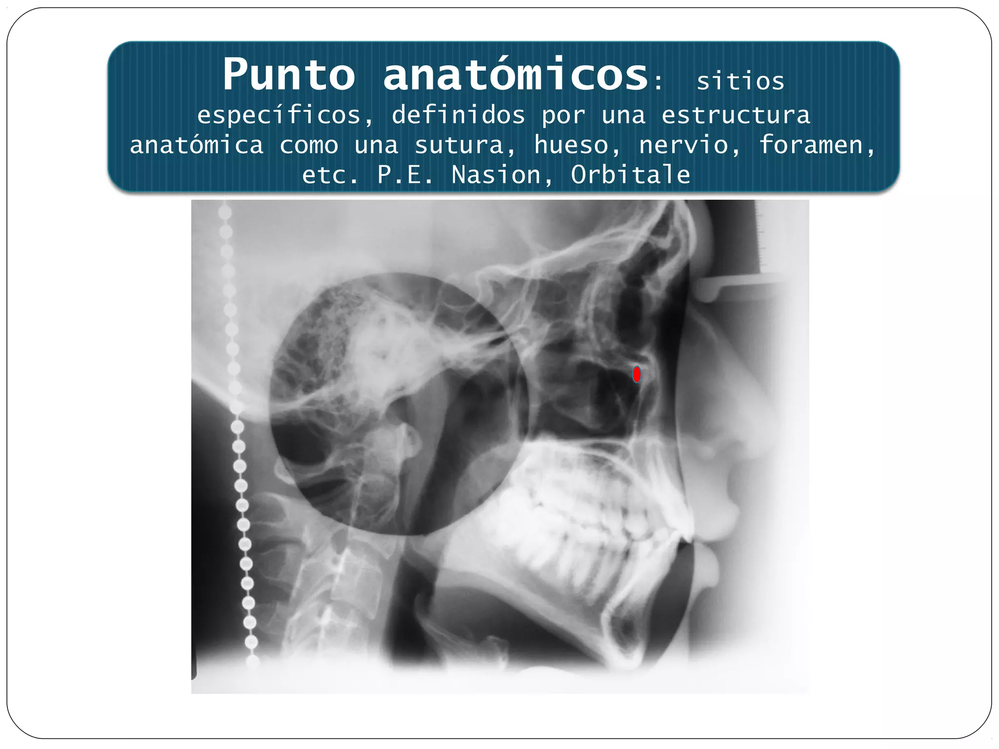Cefalometria puntos y planos | PPT