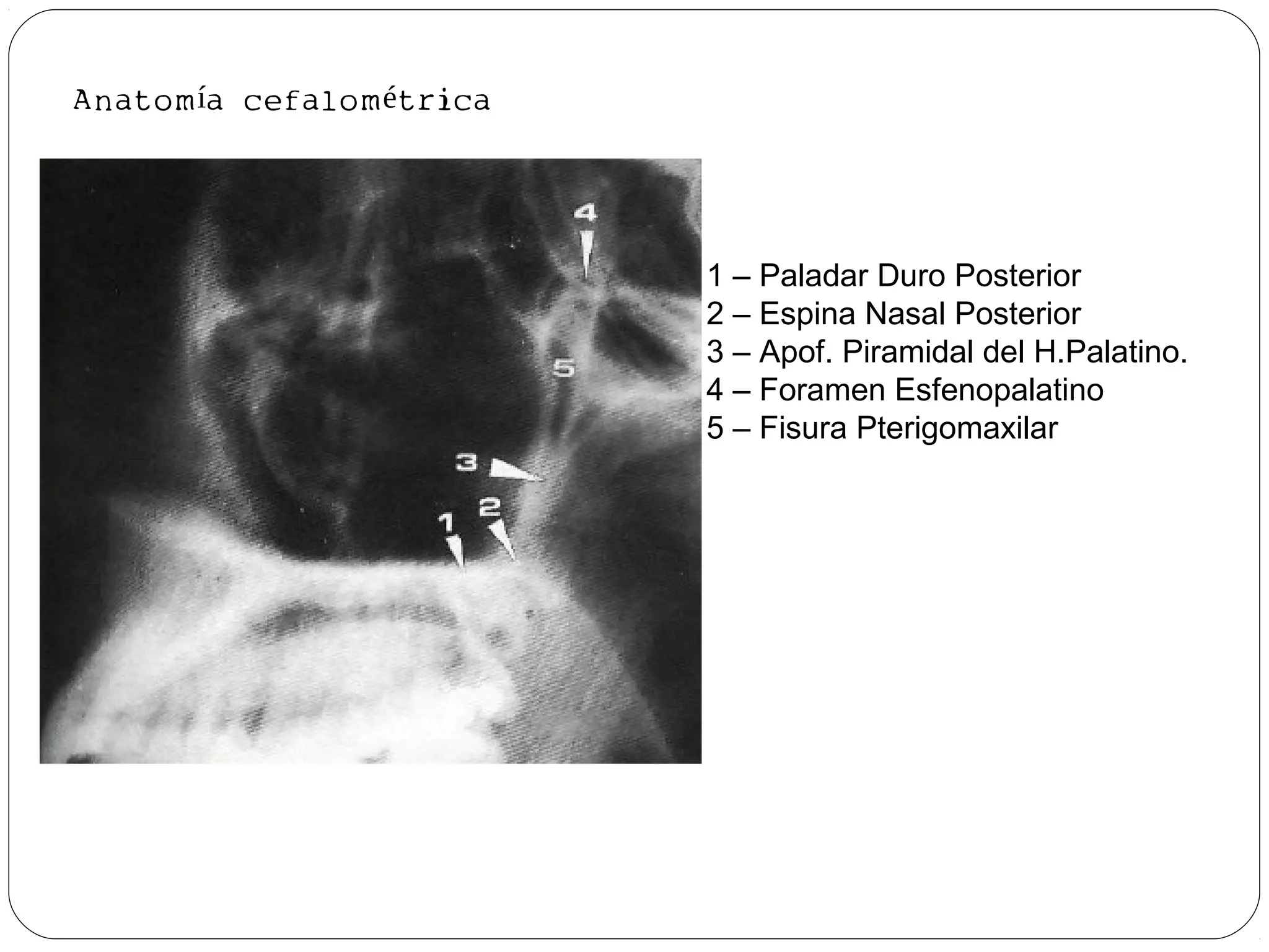 Cefalometria puntos y planos | PPT