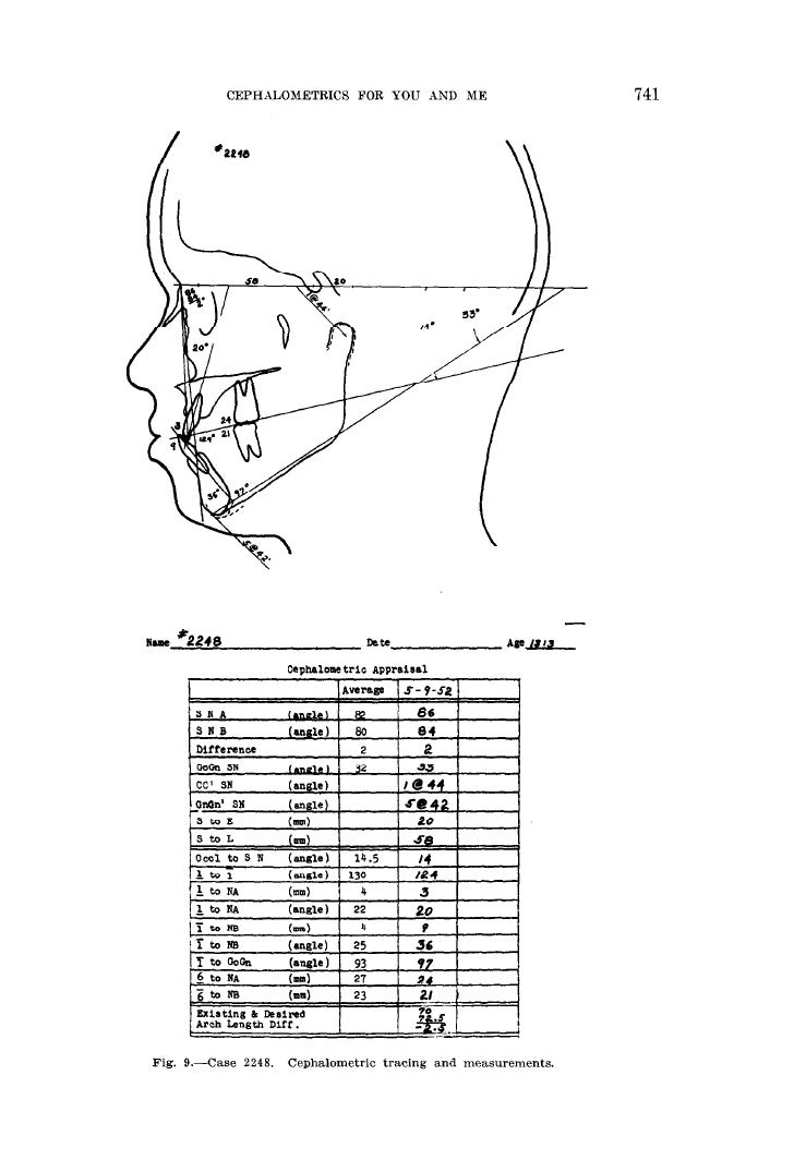 Cefalometria Steiner