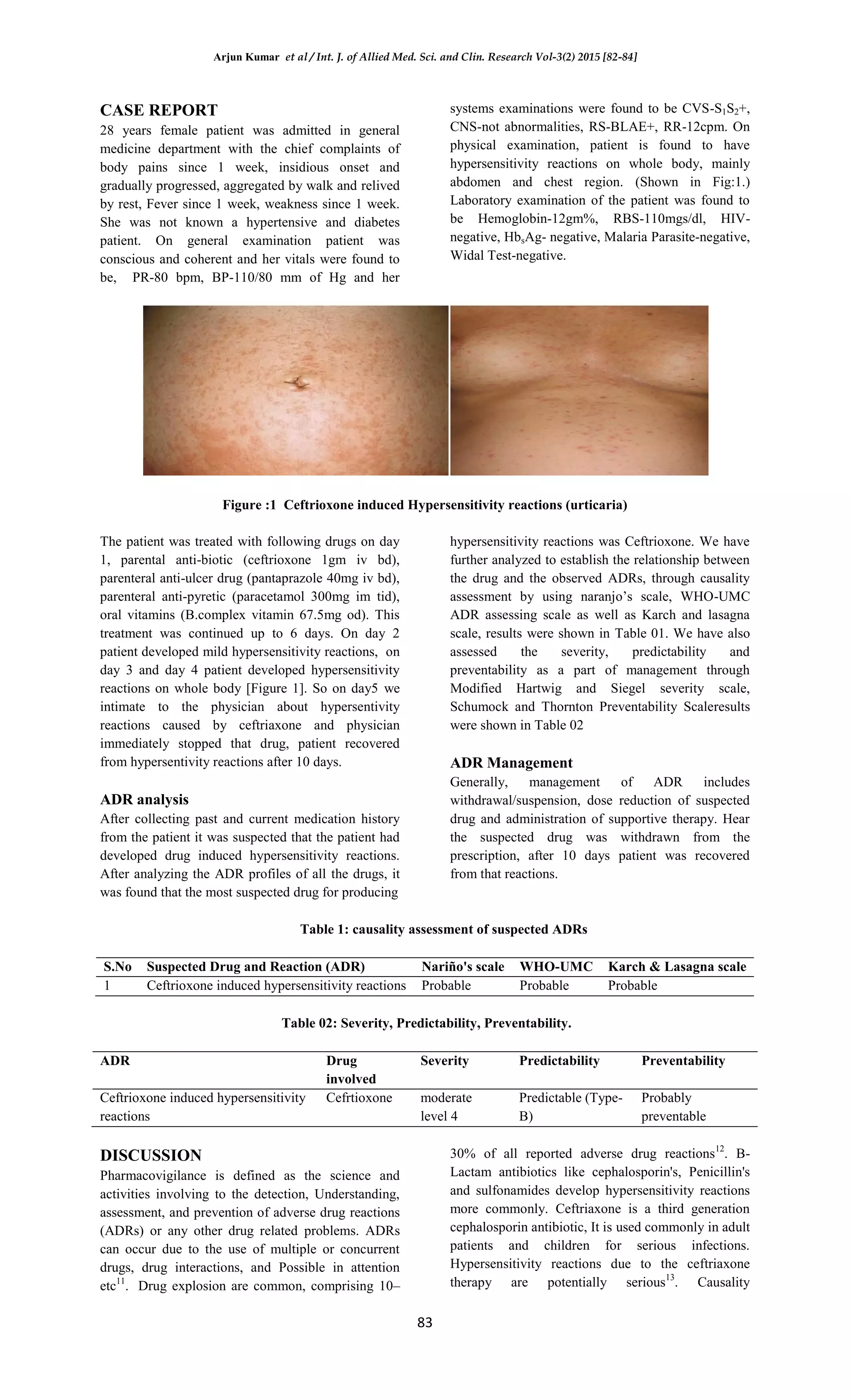 Ceftriaxone induced hypersensitivity reactions | PDF