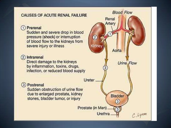 The Pathophysiology Of Acute Renal Failure