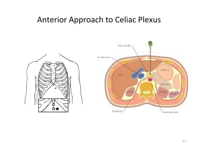 celiac | PPT