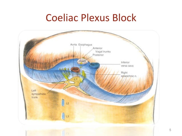 celiac | PPT