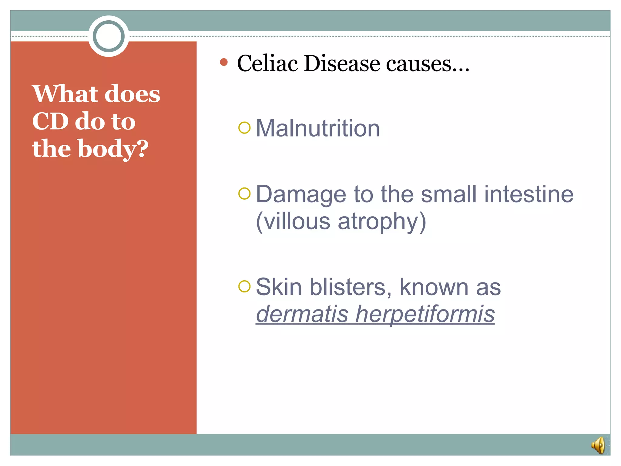 Celiac Sprue | PPT