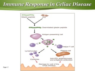 Celiac disease | PPT