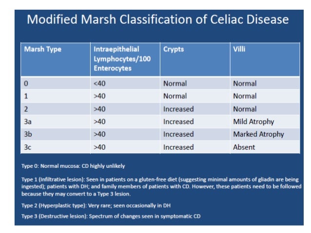 Celiac disease