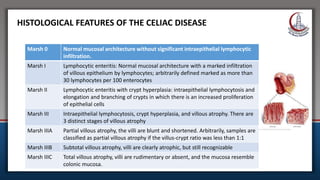 Celiac disease | PPTX