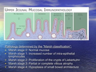 Nutritional Science Research: Celiac Disease & Risk of Subsequent Type ...