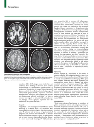 Celiac disease from gut to brain | PDF