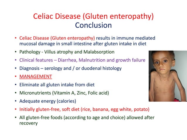 Celiac disease in children 2021 | PDF | Digestive Disorders | Diseases ...