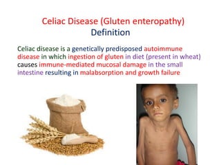 Celiac disease in children 2021 | PDF