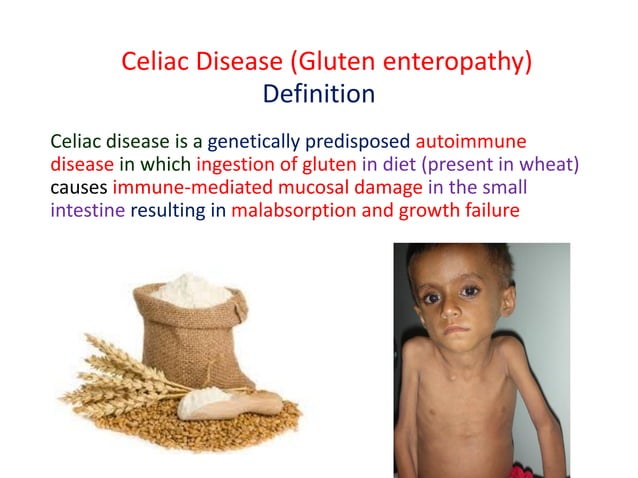 Celiac disease in children 2021 | PDF | Digestive Disorders | Diseases ...