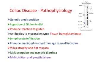 Celiac disease in children 2021 | PDF