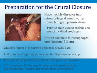 Non Invasive Surgeries | PDF