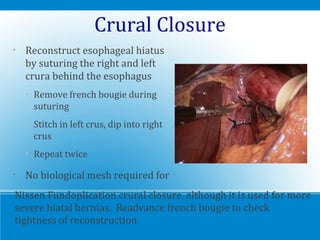 Non Invasive Surgeries | PDF