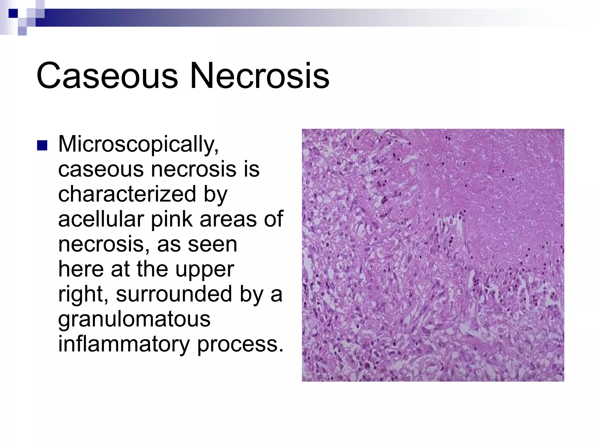Cell- injury-and-Cell-Death-1.ppt