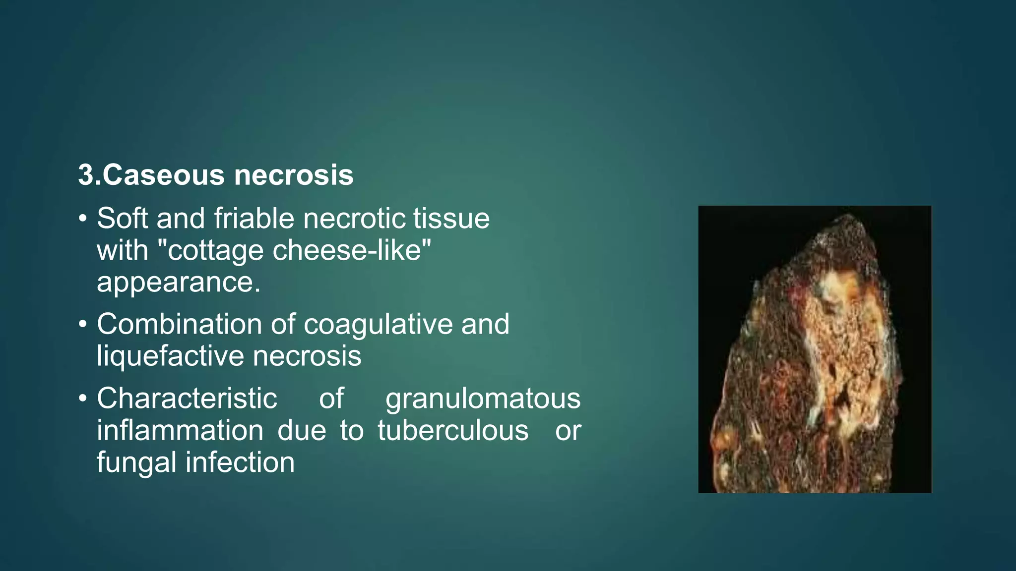Cell adaptation & Cell injury and Cell death | PPTX