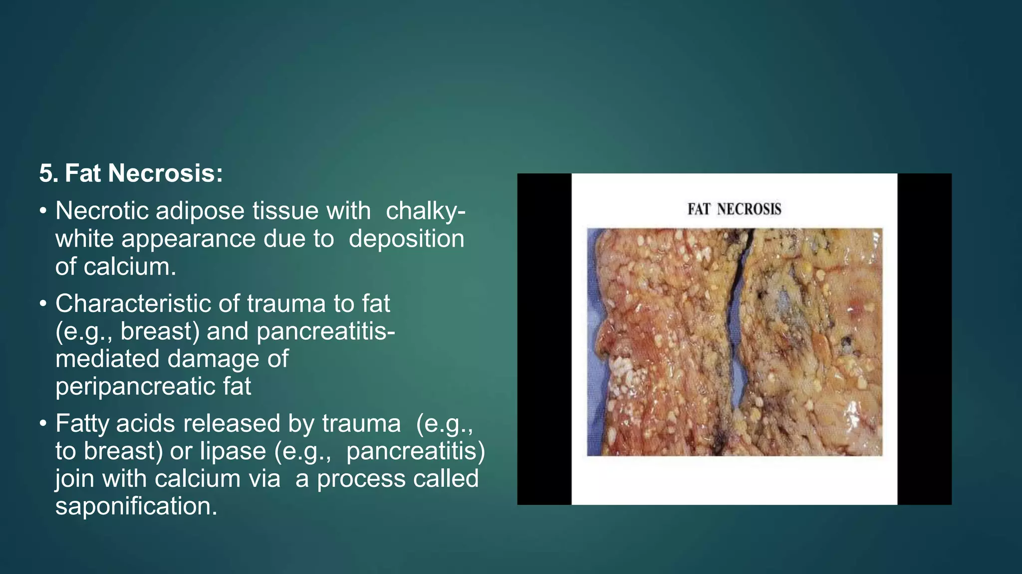 Cell adaptation & Cell injury and Cell death | PPTX