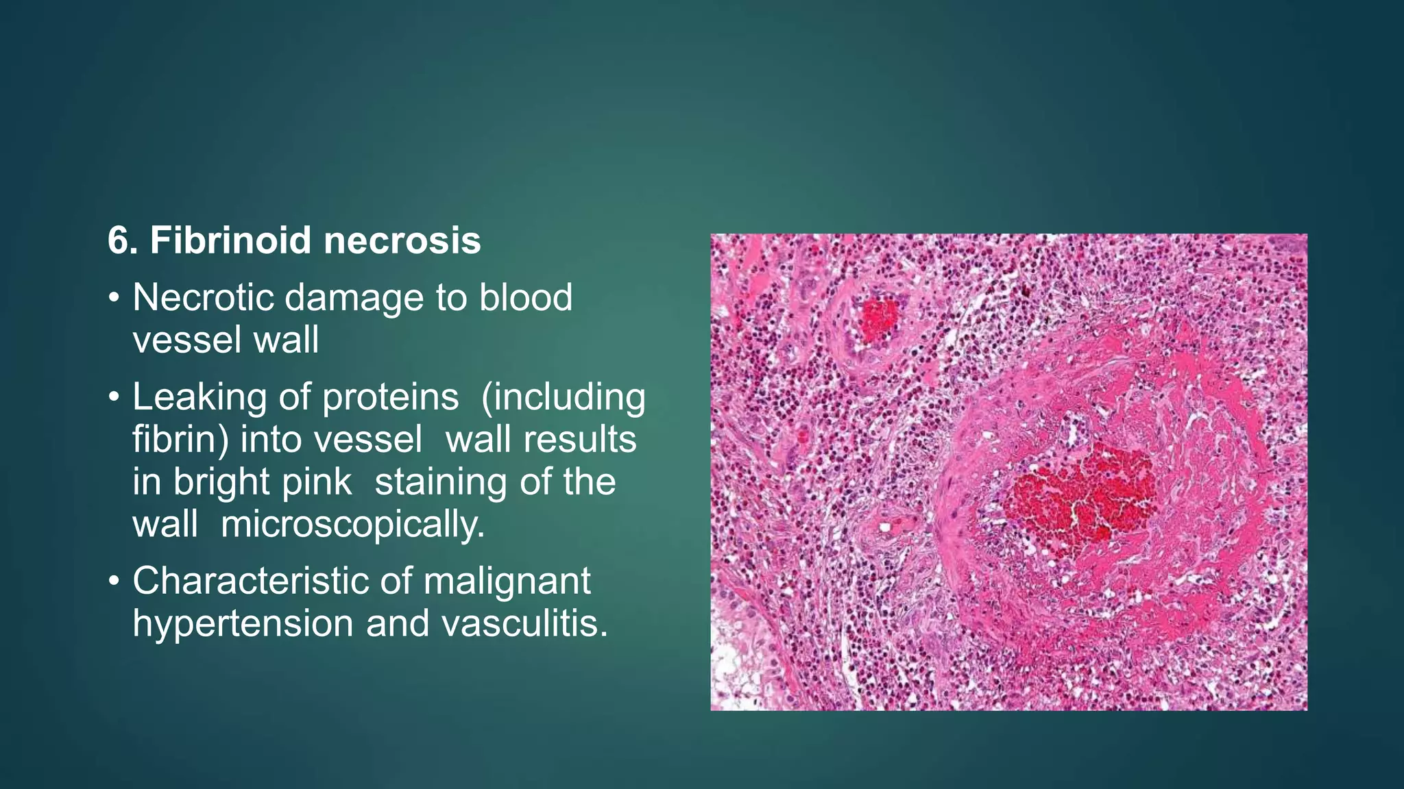 Cell adaptation & Cell injury and Cell death | PPTX
