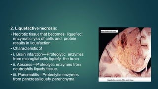 Cell adaptation & Cell injury and Cell death | PPTX