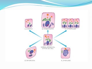cell adaptation or cellular adaptation-190708165026.pptx | Endocrine ...