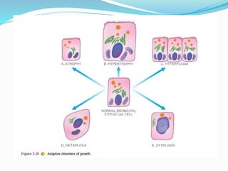 Cellular or Cell adaptation !! pathology - Harsh mohan !! cell injury ...