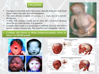 Cell Biology Ppt || Hedgehog Signalling Pathway & it's related ...