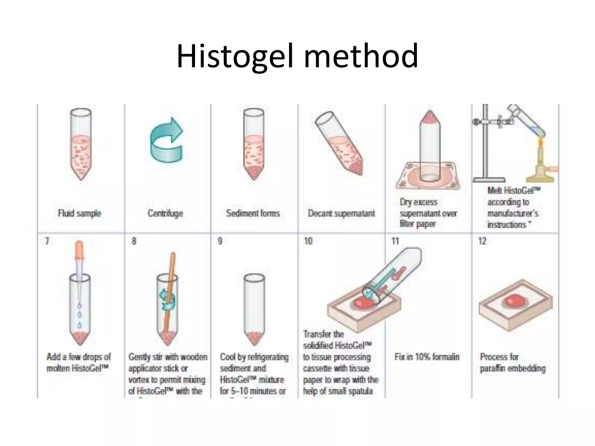 Cell block and its diagnostic utility | PPTX