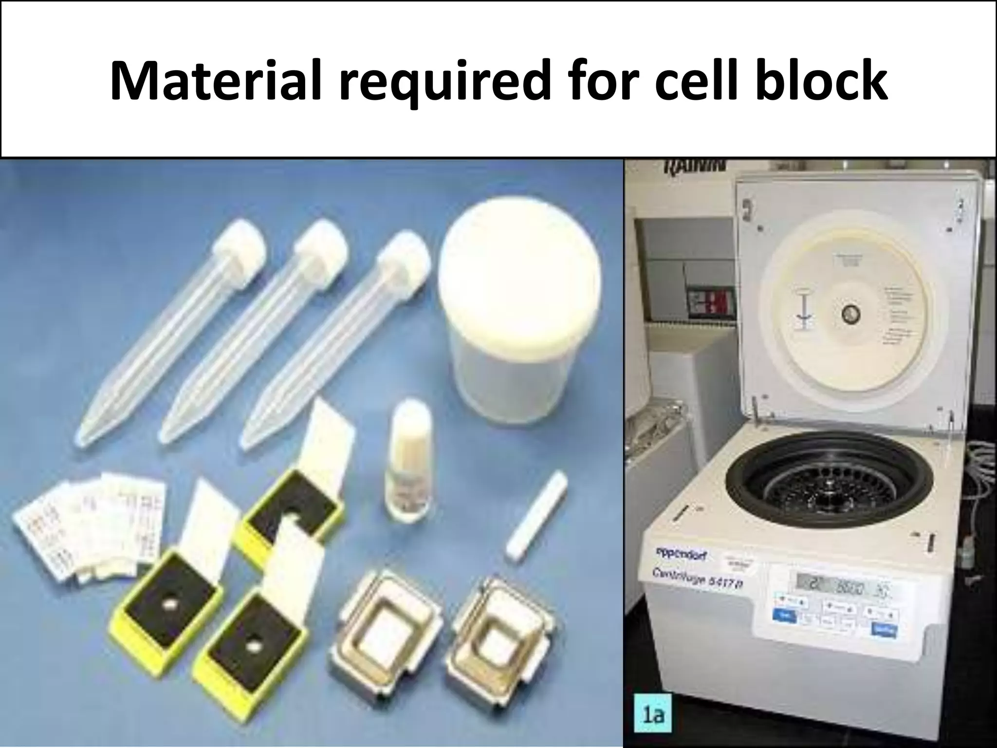 Cell block and its diagnostic utility | PPTX