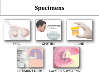 Cell block and its diagnostic utility | PPTX