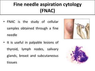 Cell block and its diagnostic utility | PPTX