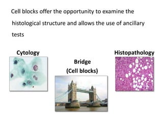 Cell block and its diagnostic utility | PPTX