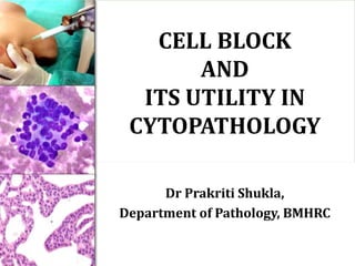 Cell block and its utility | PPTX
