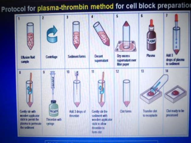 Cell block and liquid based cytology | PPTX