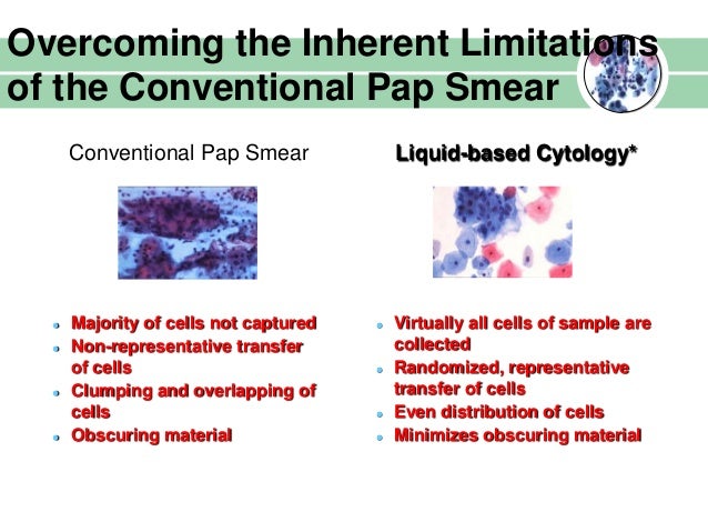 Cell block and liquid based cytology